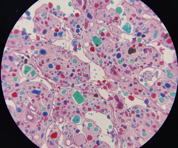 New Global Alarms: Microplastics Found Deep Inside Human Organs — What ...